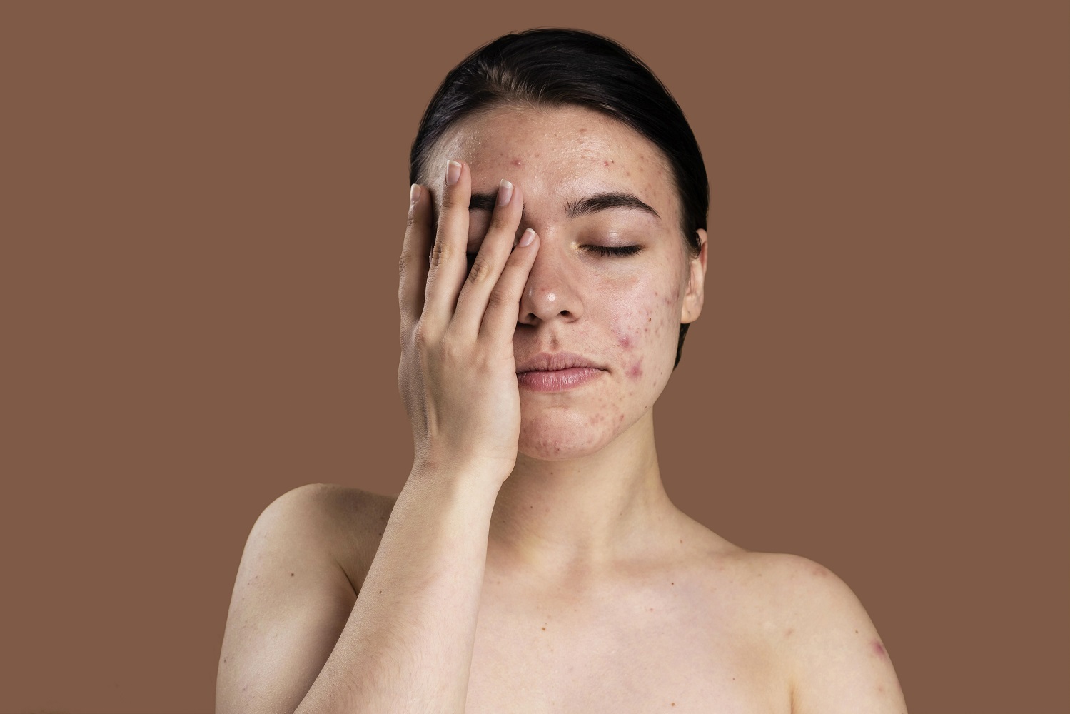 Skin Diseases - Homeopathic Clinic